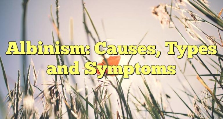 Albinism: Causes, Types and Symptoms