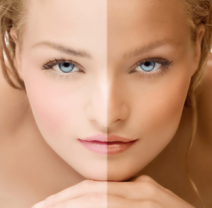 Skin Discoloration: What Is It & How To Fix It - smacr.com